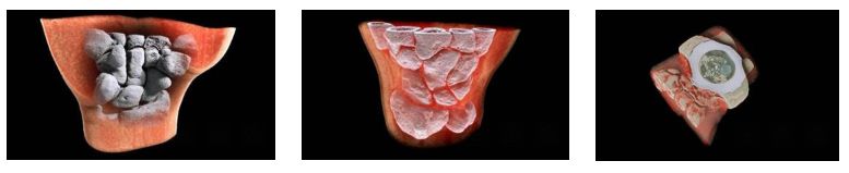 Business.Scoop » MARS Bioimaging Closes $15M Series A To Scale Portable ...